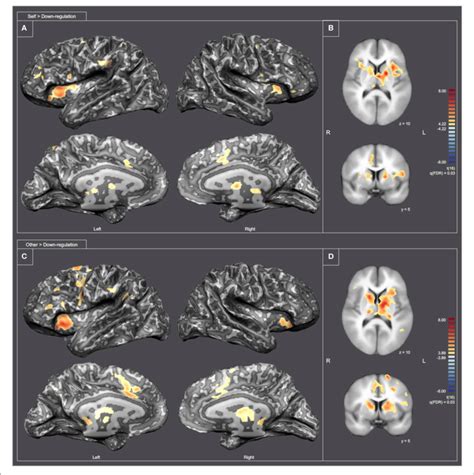Statistical Map Representation For The Imagery Runs Rfx Glm Qfdr Download Scientific