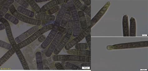 Light Photomicrographs Of Strains Of Oscillatoria Sp Nov Download