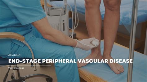 End Stage Peripheral Vascular Disease Symptoms And Risk Factor