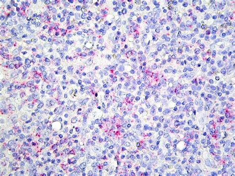 Assay Database Navinci