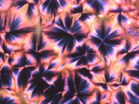 Diagnostics With Birefringence