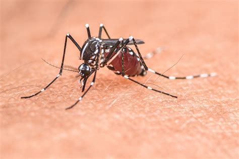 Épidémie Cest Une Saloperie De Maladie Jai Cru Y Laisser Ma