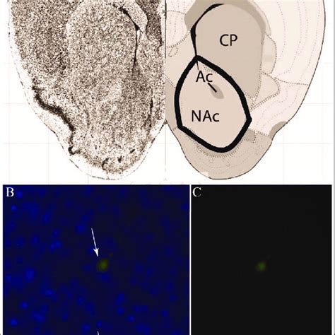 A Diagrammatic Representation Of The Dissection Of Nucleus Accumbens