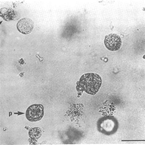 Photomicrograph Of Protoplasts That Have Grown But Have Not Regenerated