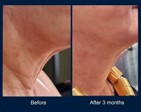 Evocyte Uk And Ireland On Linkedin Evocyte London Exosomes