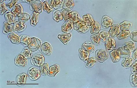Tree Pollen Under Microscope