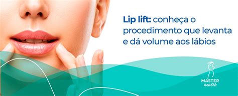 Lip Lift O Procedimento Para Dar Um Up Nos Lábios Blog Master Health