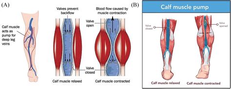 Is it Important to Hit Calves on Leg Day? — Treadwell, DPT