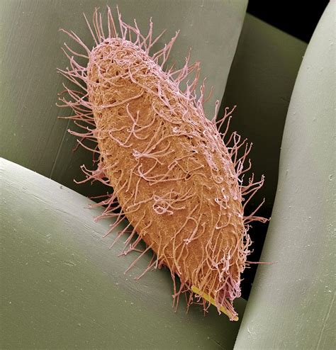 Ciliate Protozoan Sem Photograph By Science Photo Library Pixels