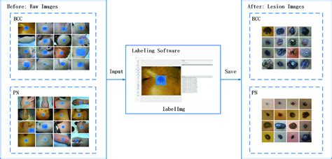 Data Labeling Operation Software Of LabelImg Was Used To Get The Lesion