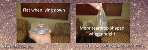 7th Generation Breast Implants Softer Safer Less Ripply