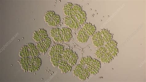 Botryococcus Algae Time Lapse Light Microscopy Footage Stock Video