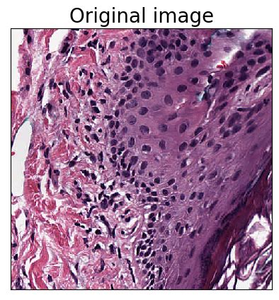 Preprocessing H E Stain Normalization PathML Documentation