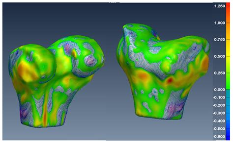 Automatic Bone Segmentation From Mri For Real Time Knee Tracking In