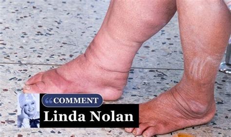 Linda Nolan Feet
