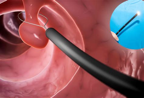 Advanced Gi Endoscopy Surat Gestro Center