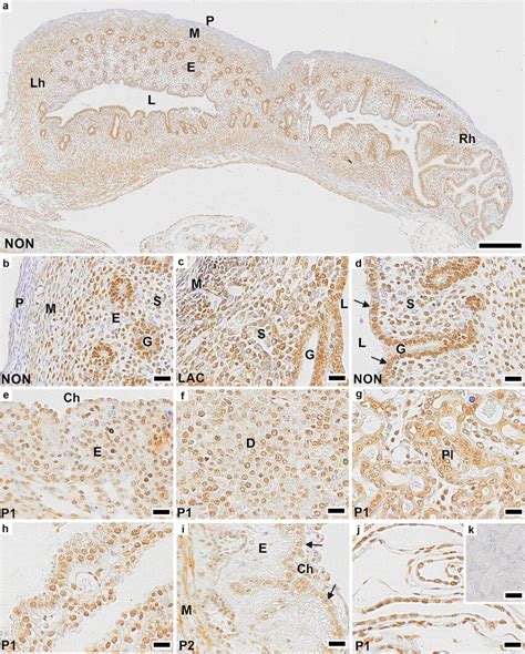 Expression of estrogen receptor alpha ERα in the uterus of Myotis Download Scientific Diagram