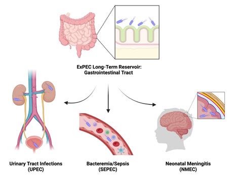 Extraintestinal Pathogenic E Coli Expec Creative Diagnostics