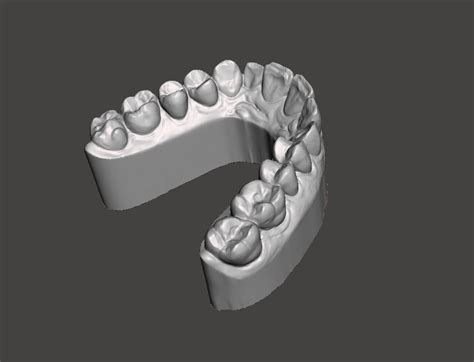 Stl File Dental Models・3d Print Design To Download・cults