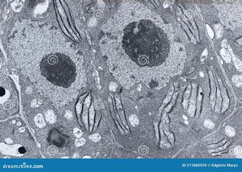 A Ultrathin Section Of Vegetal Leaf Mesophyll Cells Showing Chloroplast