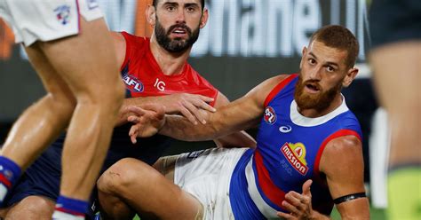 Injury Update Liam Jones