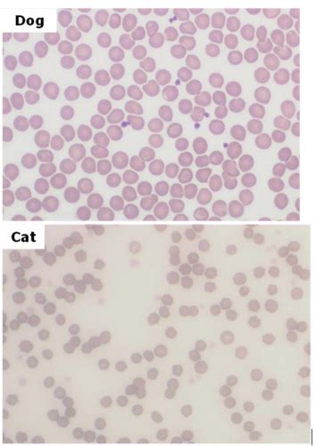 Practical Cell Identification Wbc Rbc Morphology Haemogram