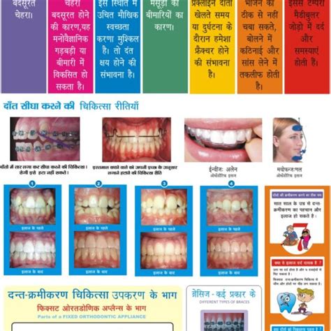 LDP 01 H Dentures Hindi Smart Doc Posters