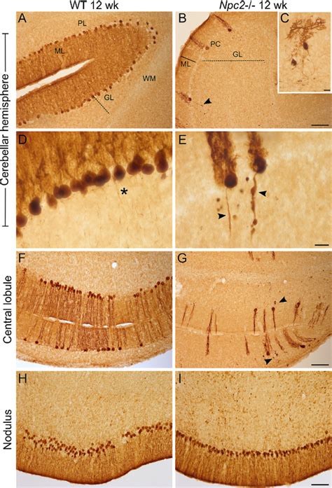 Cerebellar Purkinje Cell Pathology In 12 Weeks Old Npc2 Mice