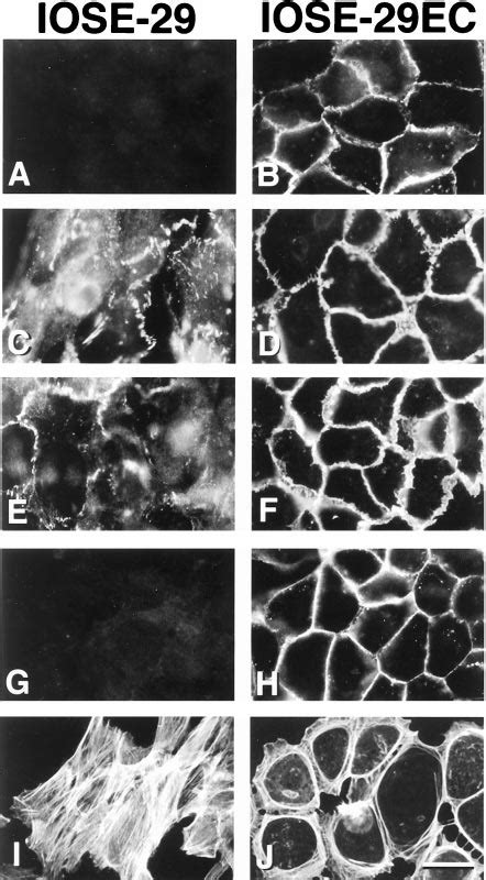 E Cadherin Catenin And F Actin Localization Iose 29 A C E G And