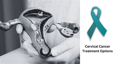Cervical Cancer Navigating Treatment Choices
