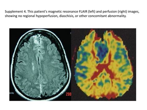 Supplement 1 This Patients Horizontal Magnetic Resonance Scan Left