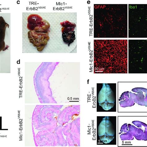 Prevalent Astrogliosis And Associated Inflammation In The Brain Induced Download Scientific