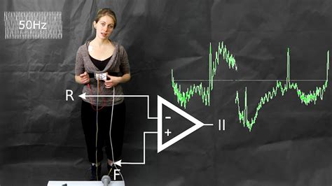 Ekg Artifacts Explained Spot The Interference Save A Life