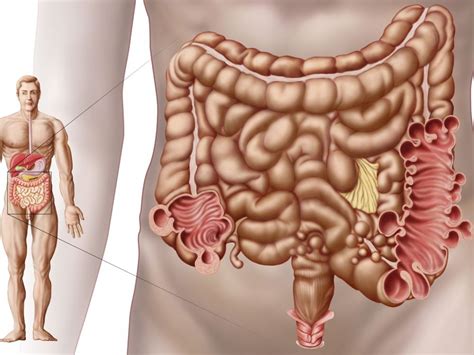 7 Penyebab Sakit Perut Sebelah Kiri Tangani Dengan Tepat