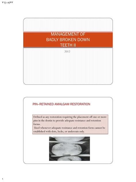 Pin Retained Amalgam Restorations Pdf