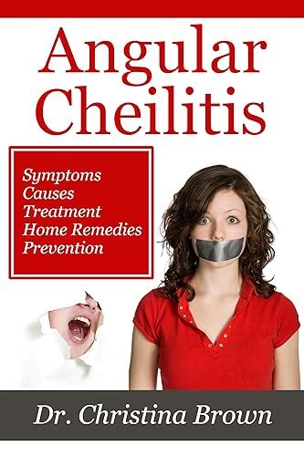 Angular Cheilitis Symptoms Causes Treatment Home Remedies Prevention In Bahrain Whizz Diseases