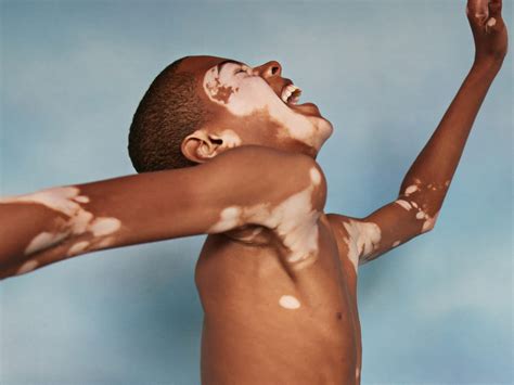 Skin Essence Essence