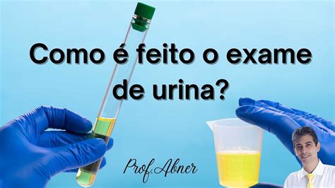 Fumei E Vou Fazer Exame De Urina