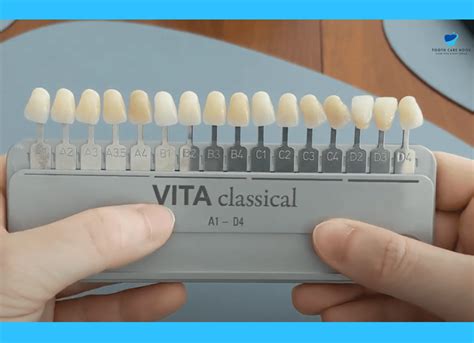 Is A1 Tooth Shade Too Whitish A Guide About Teeth Shades