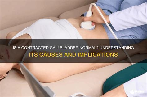 Is A Contracted Gallbladder Normal Understanding Its Causes And