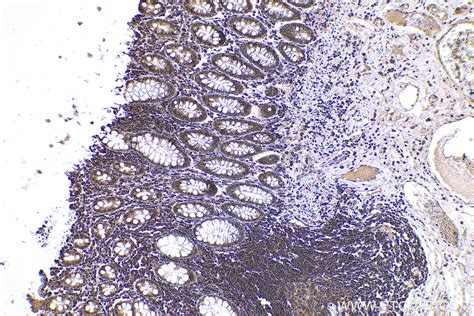 Ihceasy Ppia Ready To Use Ihc Kit Khc0654 Proteintech 武汉三鹰生物技术有限公司