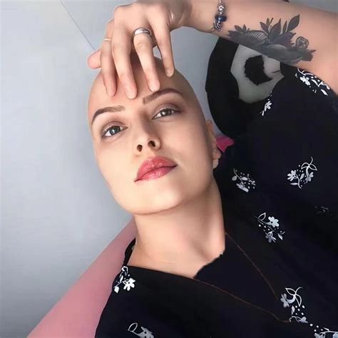 بازیگر ۳۷ ساله ترکیه ای سرطان را شکست داد