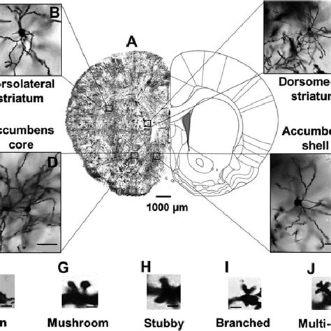 Dendritic Spine Types In Nacc Thin A Mushroom B Stubby C