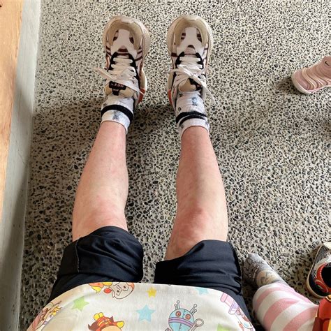 乾癬女子のお散歩スタイル 恋する毒キノコ