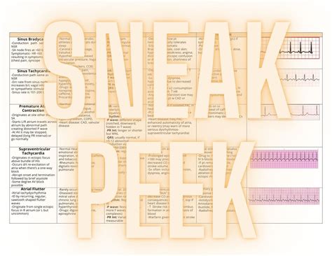 Ekg Basics Printable Chart Pdf Etsy