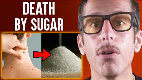 Warning Signs You Re Eating Too Much Sugar Ben Azadi Youtube