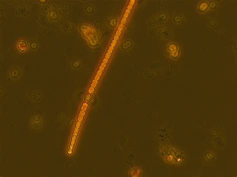 Cyanobacteria Identification Help﻿ A Slice Of Plankton