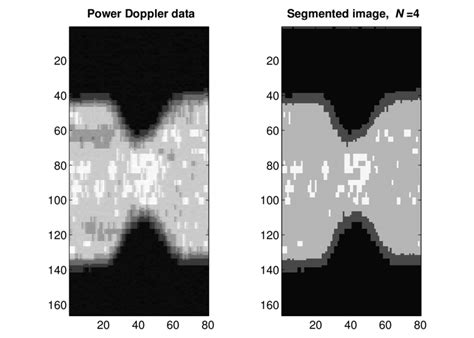 Longitudinal Slice Of 3d Data Left Original Power Doppler Data