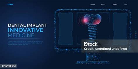 치과 임플란트의 디지털 3d 로우 폴리 모델 건강한 치아 구강 위생 치과 치료의 와이어 프레임 개념 추상적인 배경 벡터