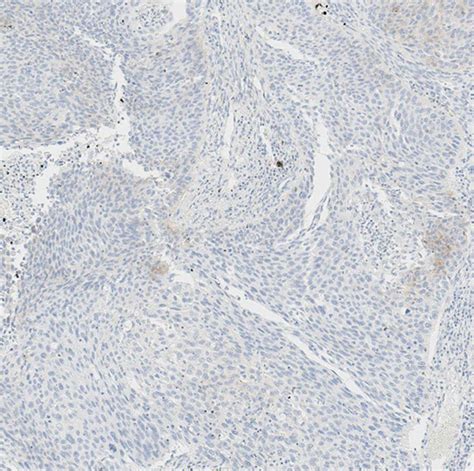 Pd L1 Sp263 Assay Tc Low Expression Estimation Tool